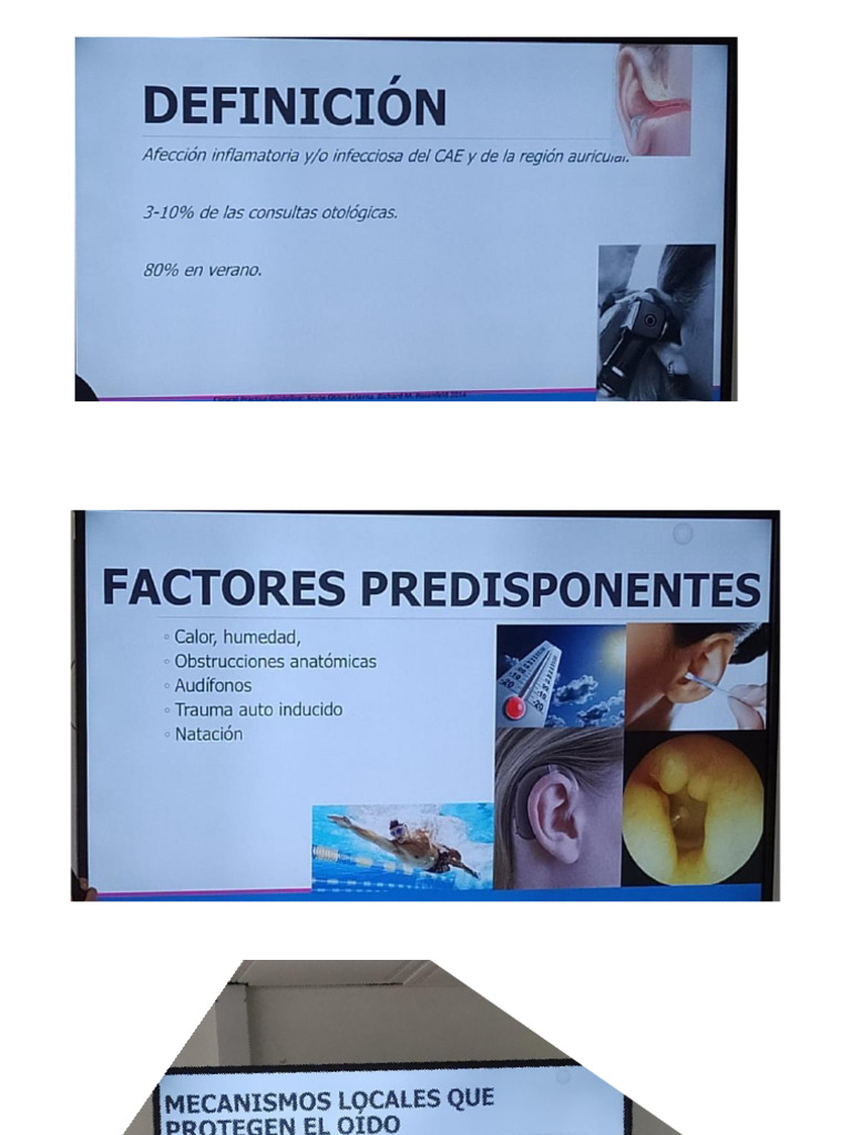 Clase de Otitis | PDF