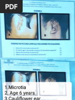 HINTS Exam for Vestibular Assessment | PDF | Vertigo | Vestibular System