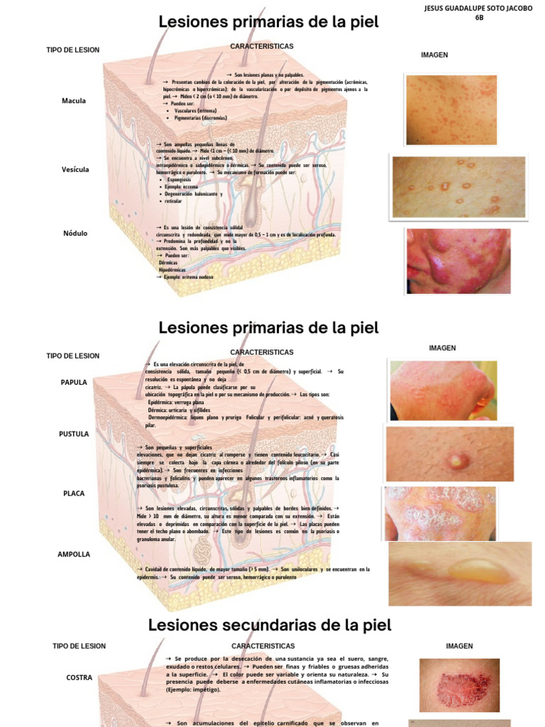Lesiones Primarias y Secundarias de la Piel | PDF | Piel | Psoriasis