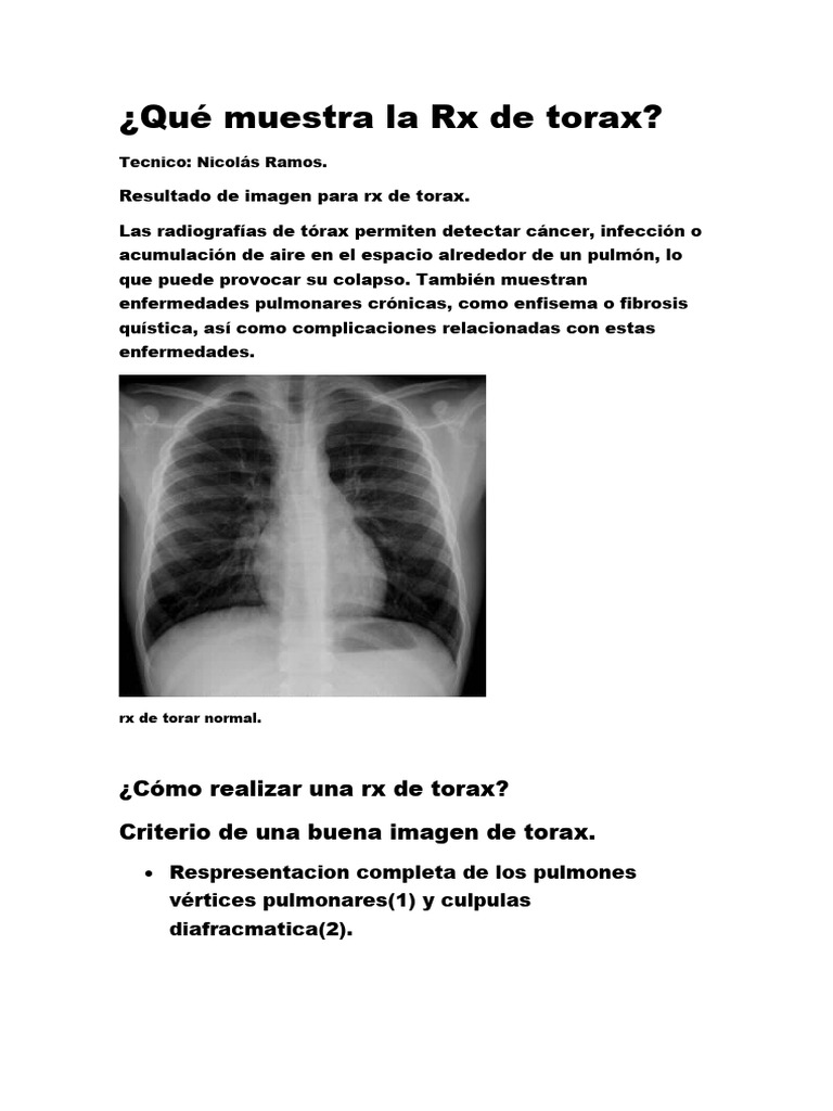 ¿Qué Muestra La RX de Torax? | Descargar gratis PDF | Cáncer de pulmón ...