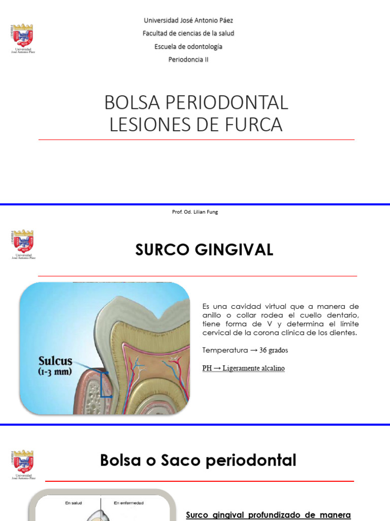 Bolsa Periodontal | Descargar gratis PDF | Ciencias de la Salud | Cuidado de la salud