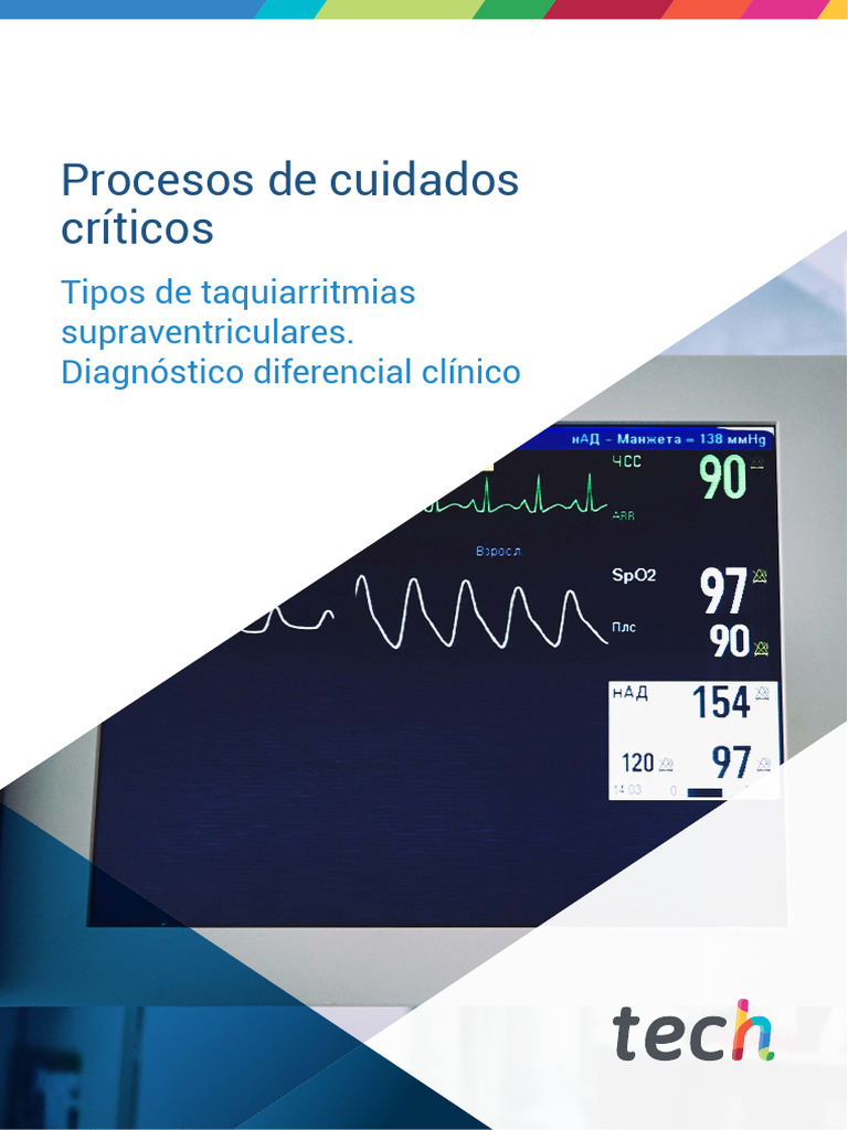 Tipos de Taquiarritmias Supraventriculares. Diagnóstico Diferencial Clínico M3 T2 | PDF ...