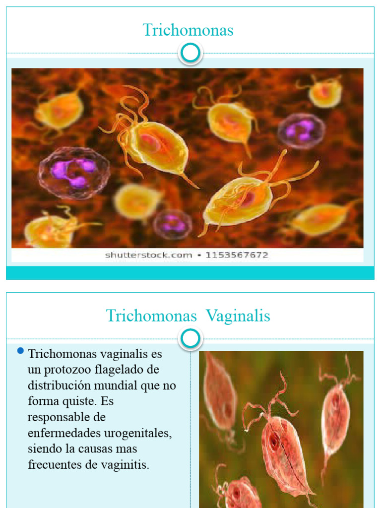 Trichomonas Vaginalis | PDF