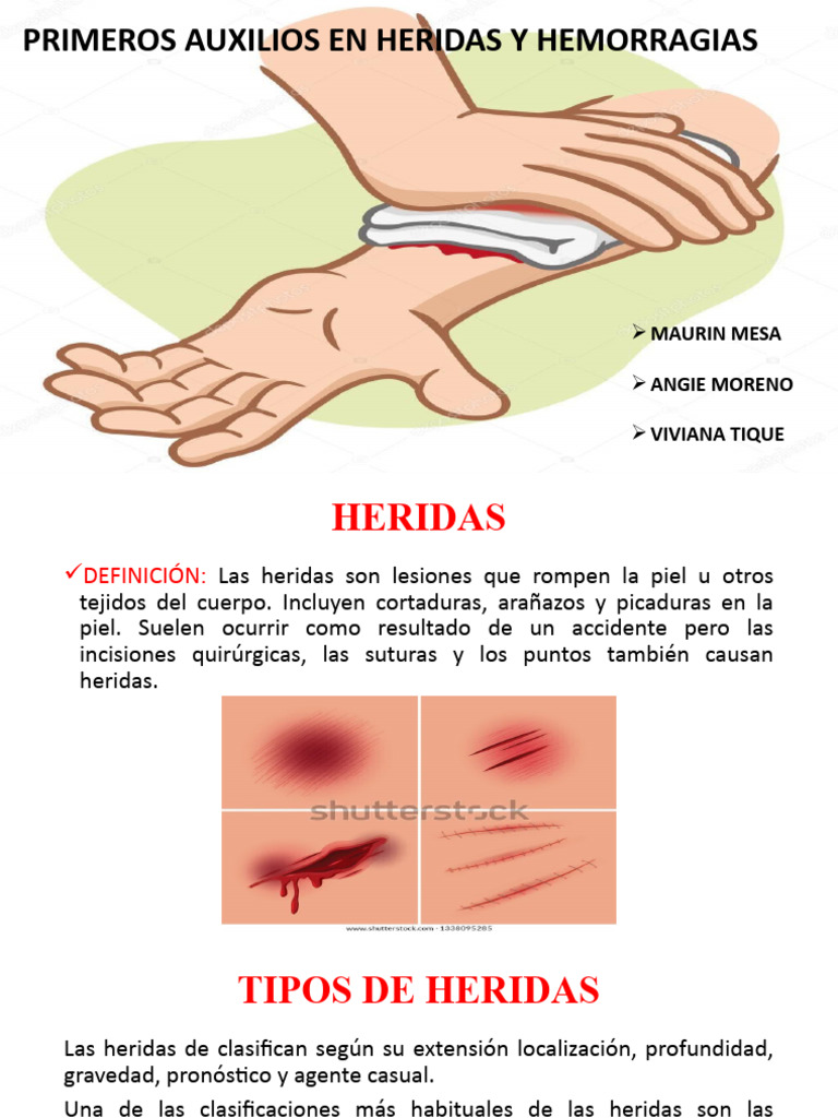 Grupo 1. Heridas y Hemorragias. | PDF | Sangrado | Primeros auxilios