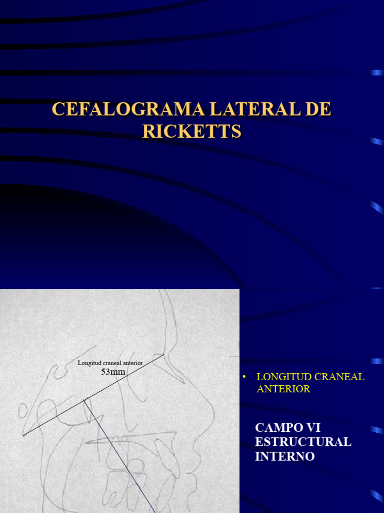 Interpretacion de Ricketts | Descargar gratis PDF | Ramas de ...