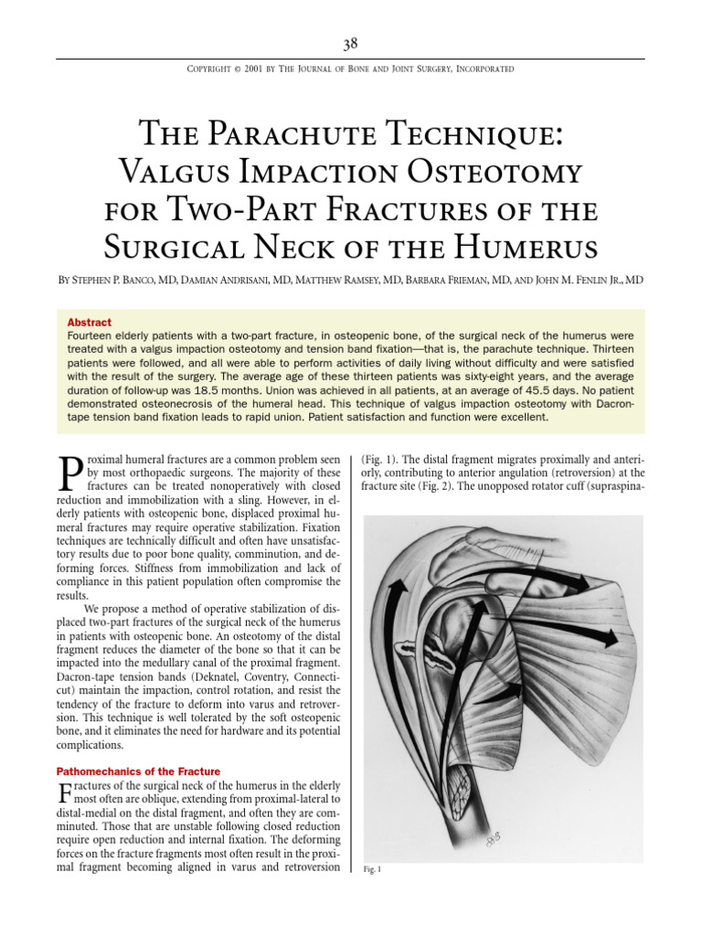 The Parachute Technique - Valgus Impaction Osteotomy For Two-Part ...