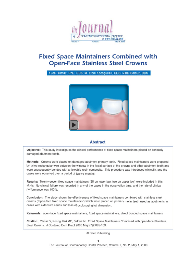 0.9 Fixed SM With Open Face SSC | PDF | Dental Composite | Human Tooth