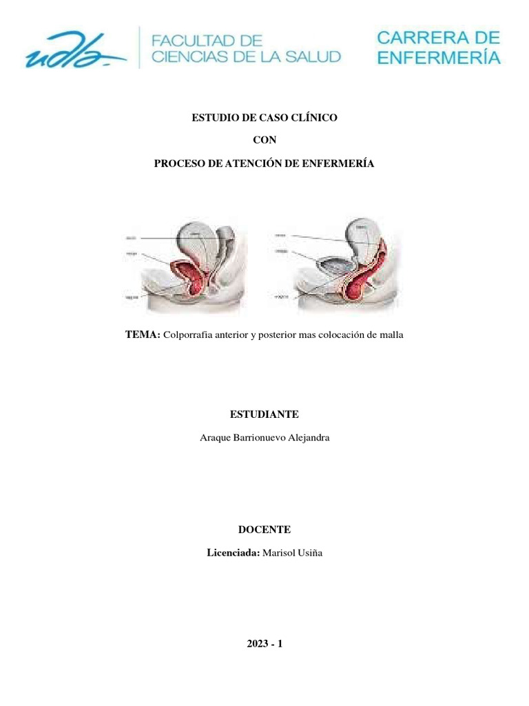 Colporrafia Anterior y Posterior | PDF | Sangre | Pelvis
