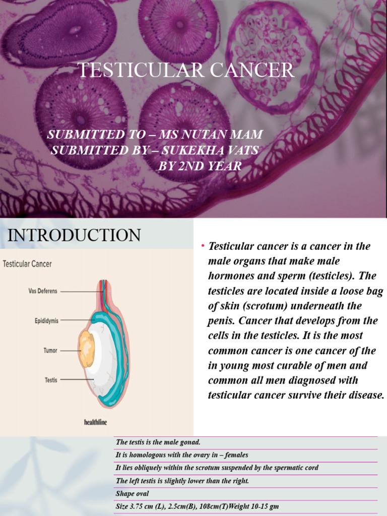 Testicular Cancer | PDF | Testicle | Cancer
