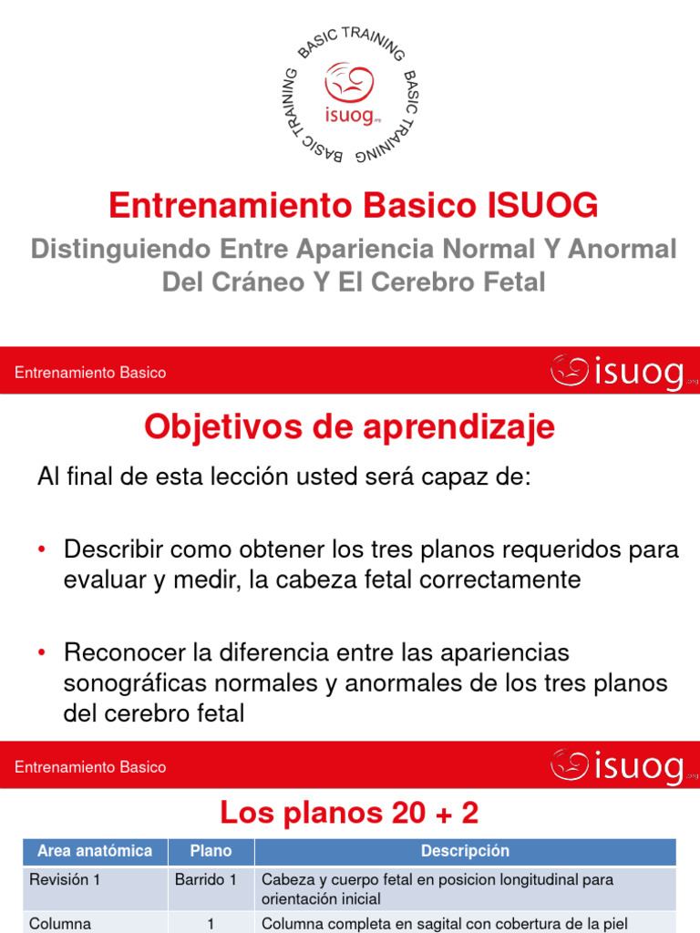 ISUOG Craneo y Cerebro Fetal | PDF | Cráneo | Cerebelo