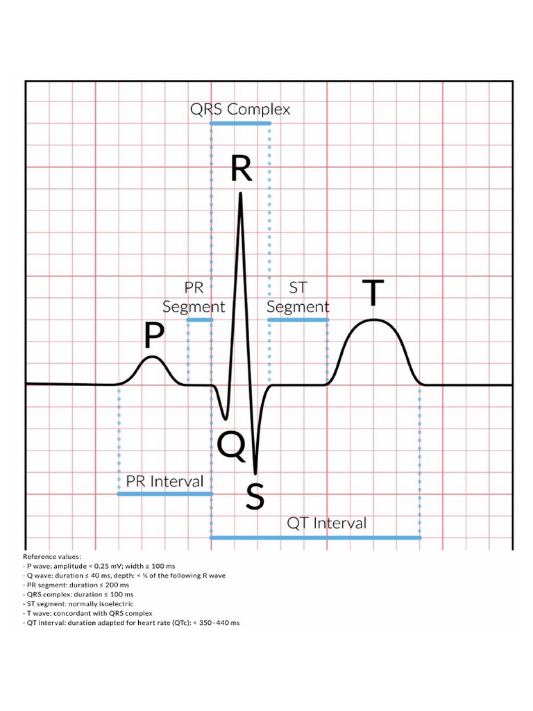 Ekg | PDF