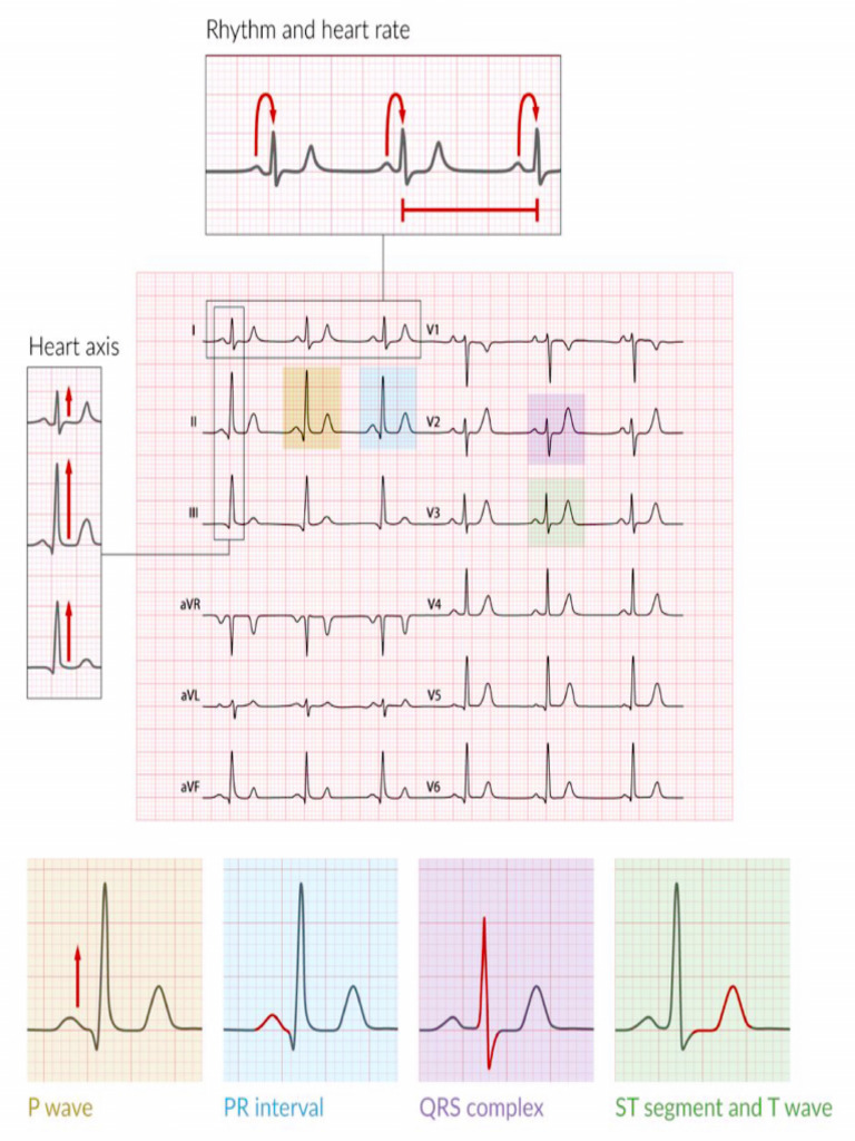 ECG Rate & Rhythm | PDF