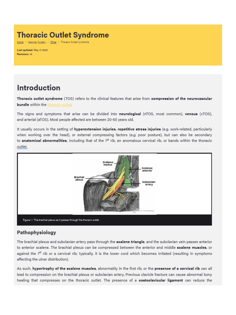 Thoracic Outlet Syndrome - TeachMeSurgery | PDF | Clinical Medicine ...