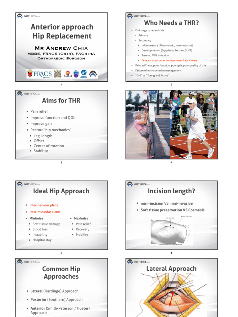 Andrew Chia: Expert in Hip Surgery | PDF | Diseases And Disorders | Surgery