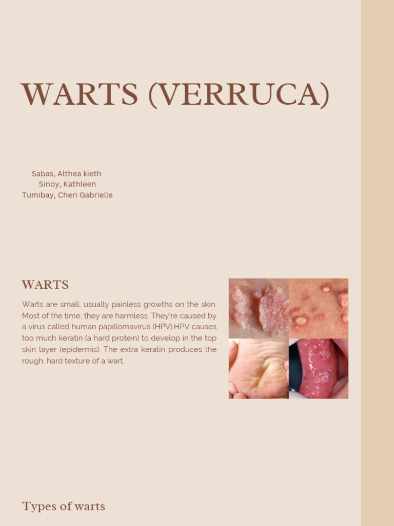 Understanding Warts: Types and Causes | PDF | Virus | Clinical Medicine