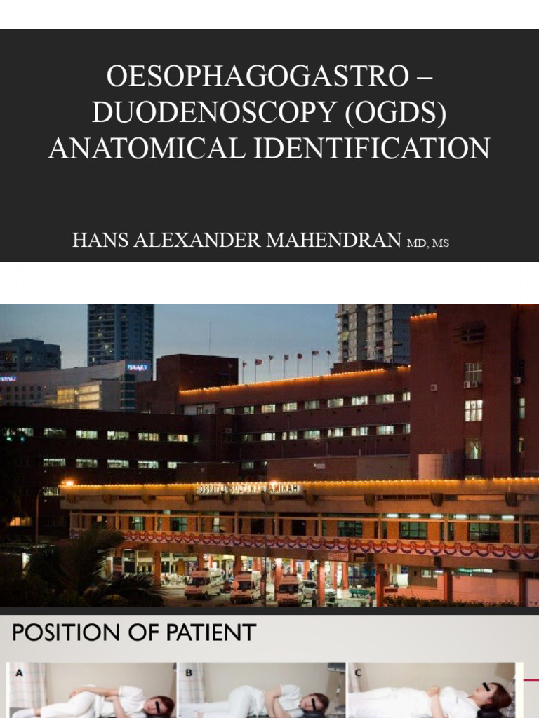 OGDS Anatomy | PDF | Stomach | Stent