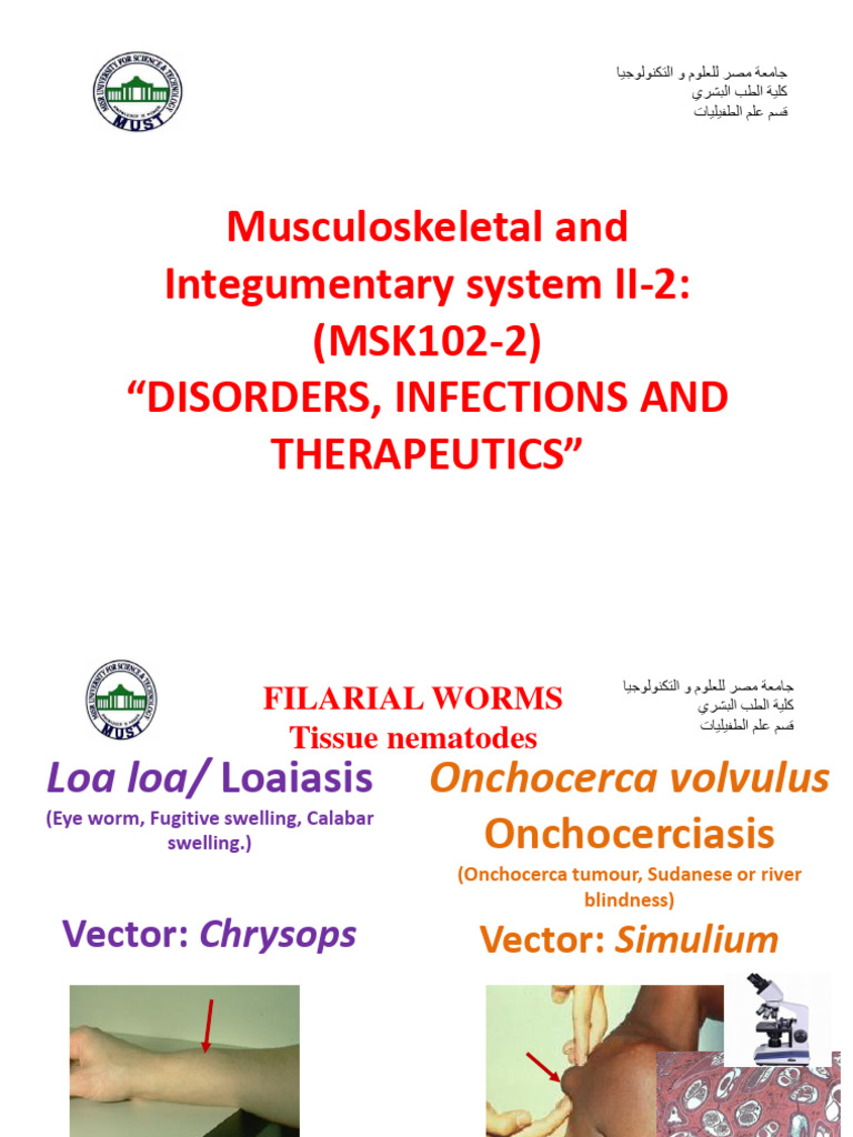 Filarial Worms: Onchocerciasis & Loiasis | PDF | Causes Of Death ...