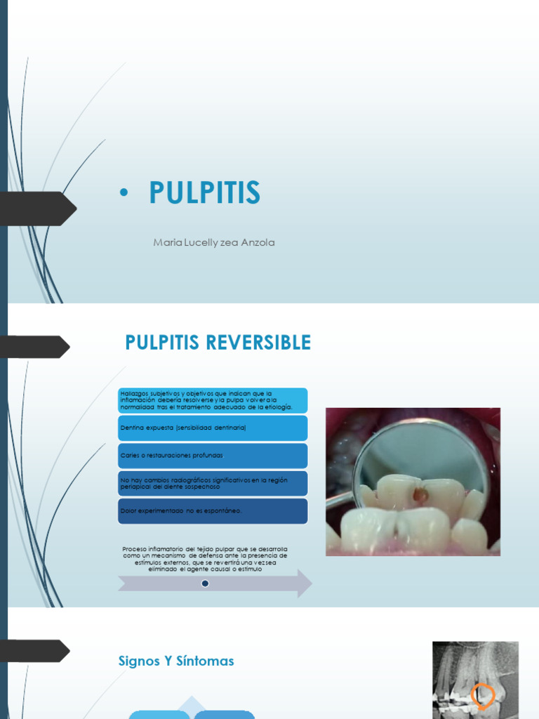 Presentación Pulpitis. | PDF | Enfermedades y trastornos | Medicina CLINICA