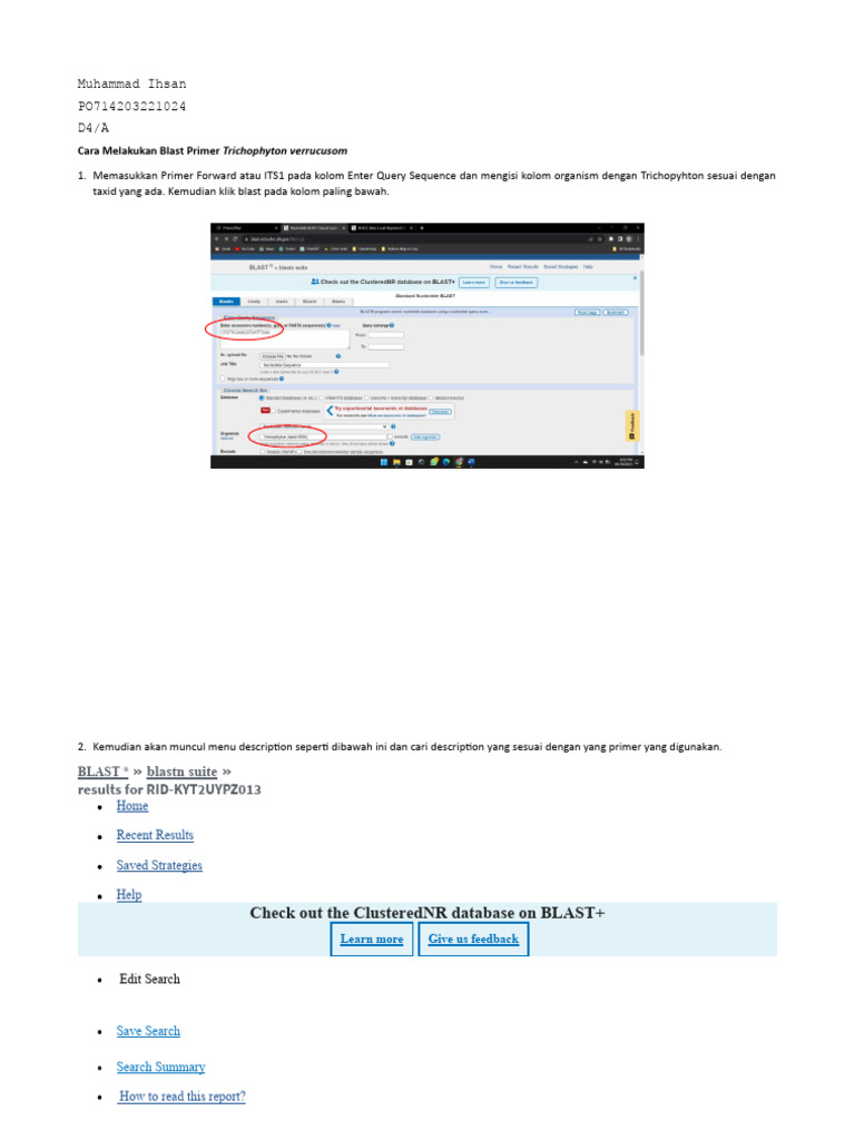 024_Muhammad Ihsan Tugas Blast Primer Trichophyton Verrucusom | PDF | Ribosomal Rna | Ribosome