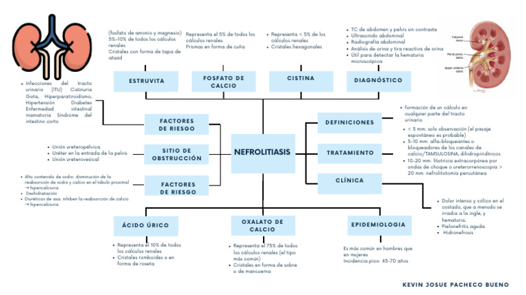 Nefrolitiasis - Mapa Mental Kevin Pacheco | Descargar gratis PDF ...