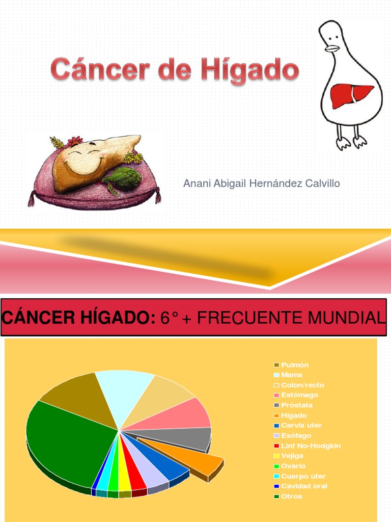Cáncer de Hígado | Neoplasias | Cáncer