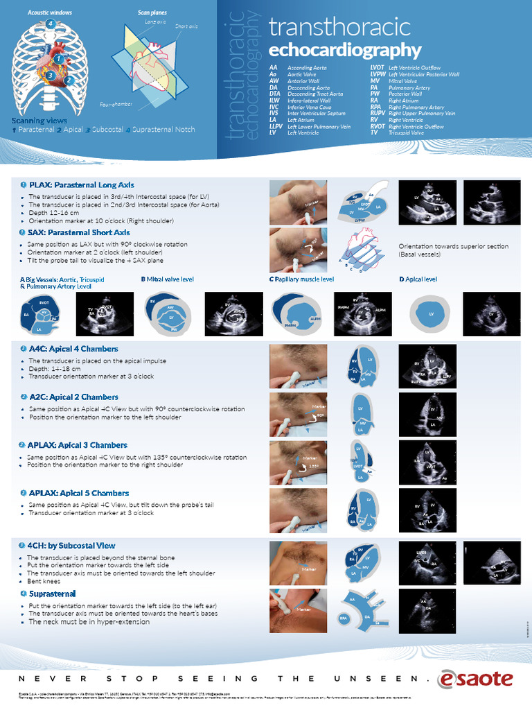 Poster Transthoracic Echocardiography 160000352 V01 0322 LR | PDF | Heart Valve | Ventricle (Heart)