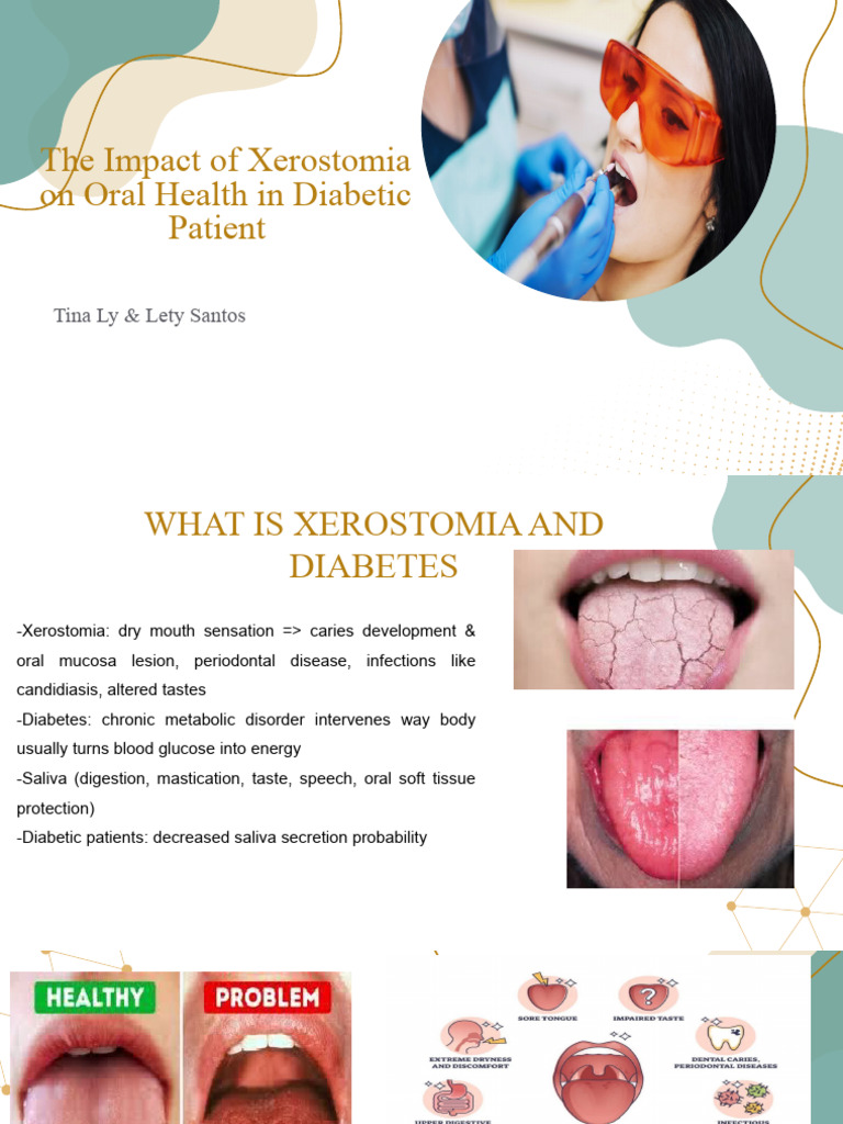 The Impact of Xerostomia On Oral Health in Diabetic Patient | PDF ...