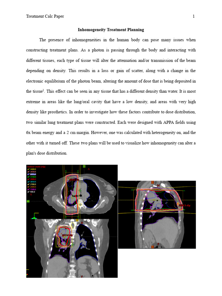 Treatmetn Calc | Download Free PDF | Ct Scan | Radiation Therapy