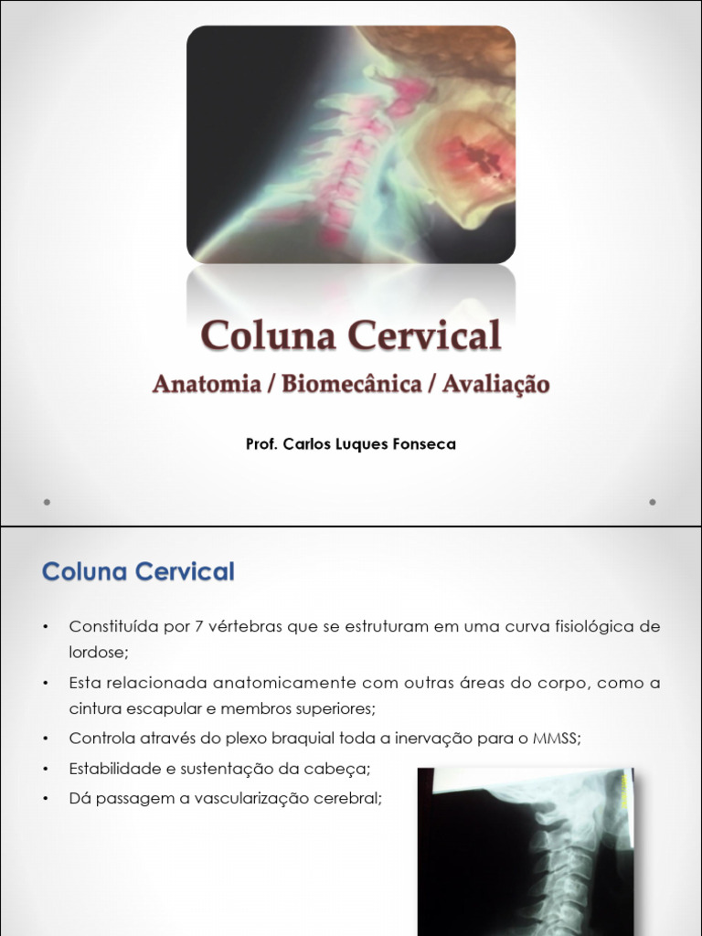 Aula - Coluna Cervical i | PDF | Coluna vertebral | Anatomia
