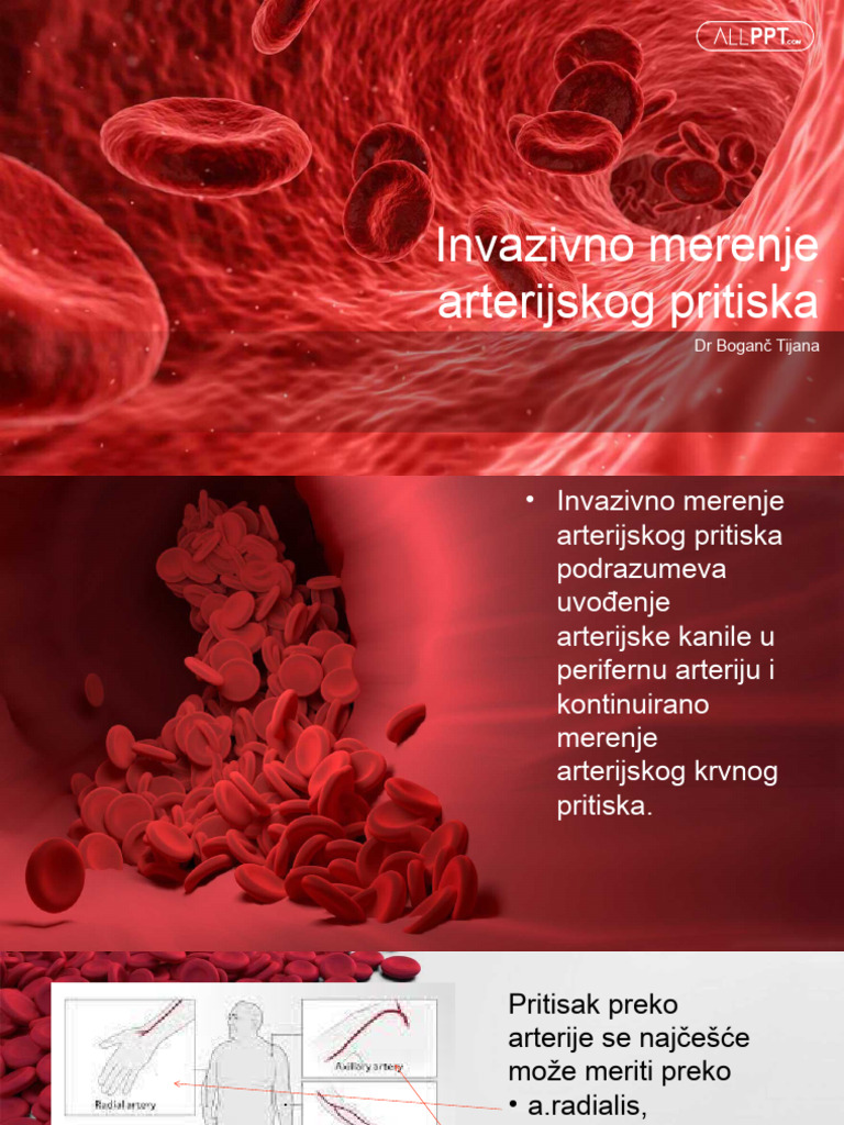Invazivno Merenje Arterijskog Pritiska | PDF