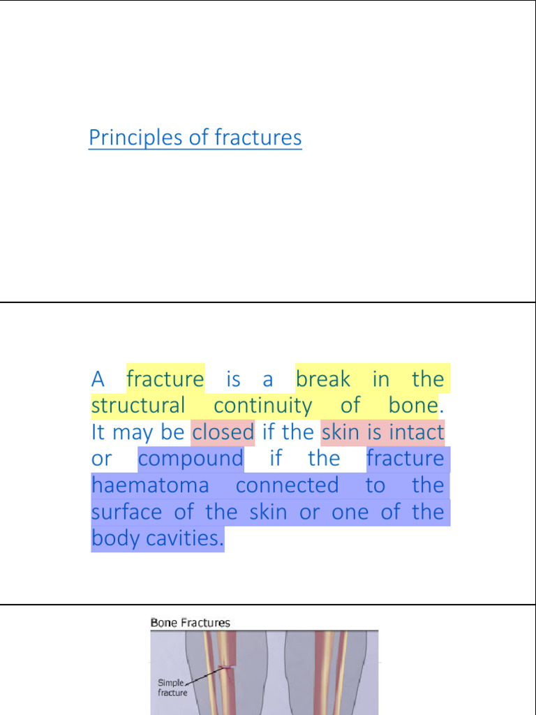 1-Fracture Definition and Classification | PDF | Bone | Musculoskeletal ...