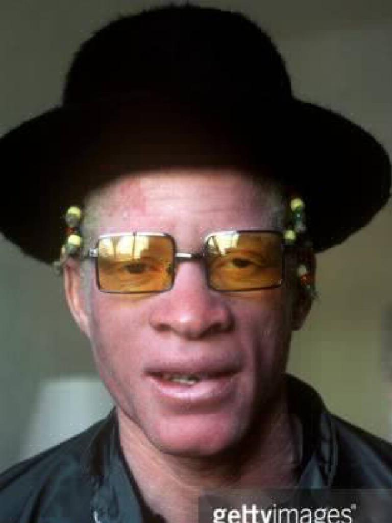 Yellowman | PDF