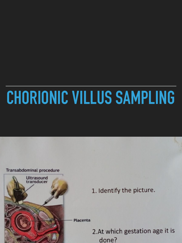Chorionic Villus Sampling | PDF