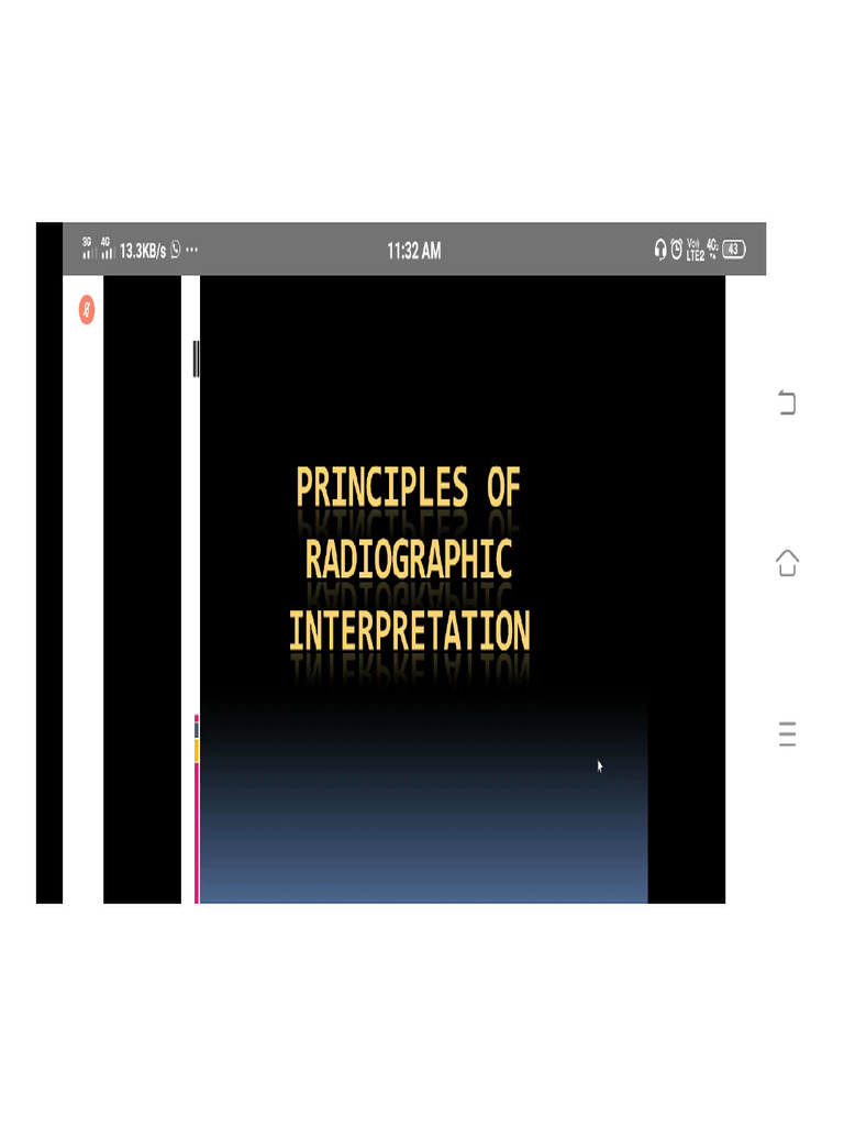 Principle and Radiographic Interpretation .... OMR.. | PDF