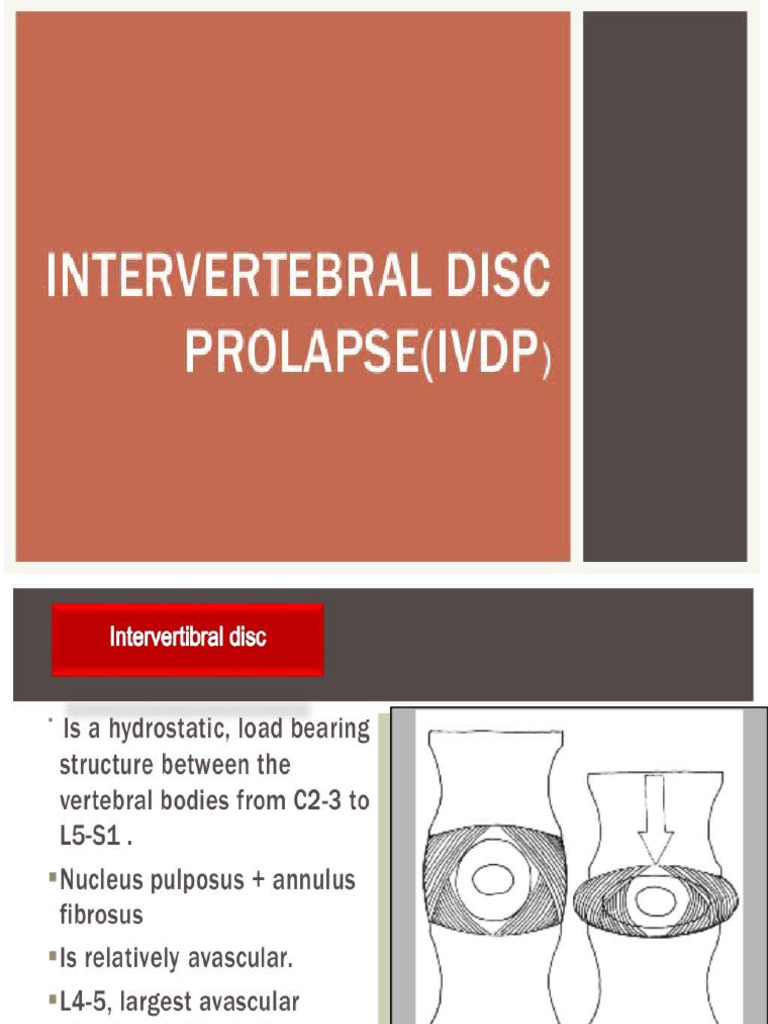 IVDP Ug | PDF
