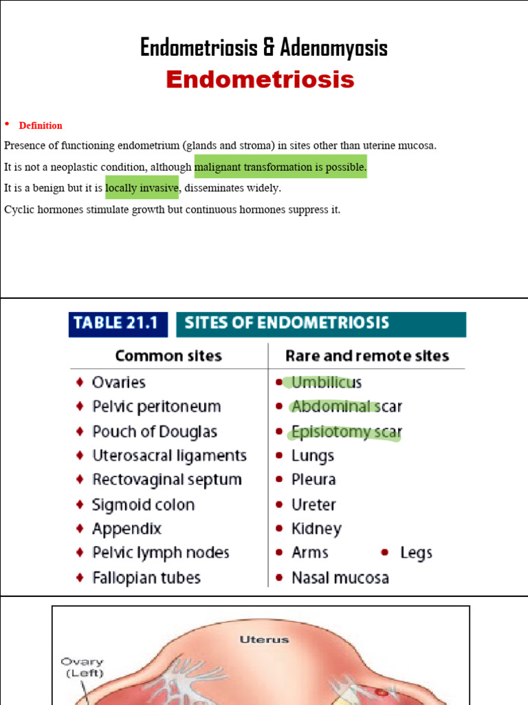 Endometriosis And Adenomyosis Pdf Human Reproduction Medicine