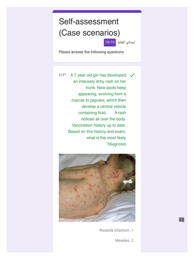 16.2 Fever and Rash (Quiz) | PDF | Measles | Medical Specialties