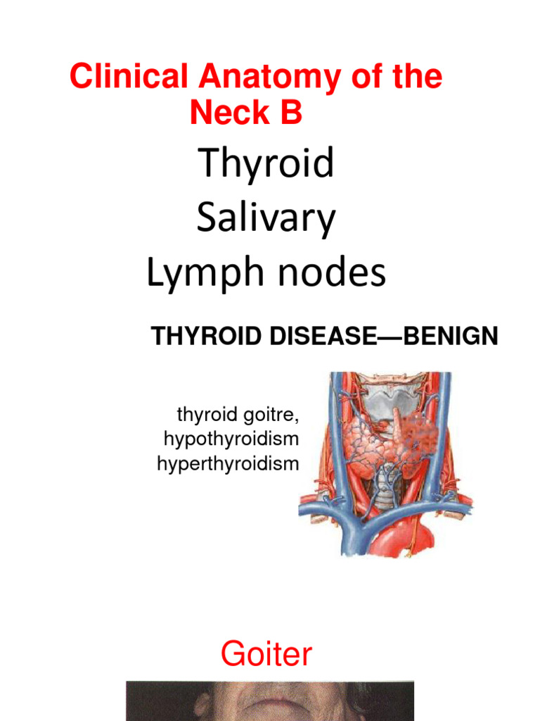 13) Thyroid , Salivary Glands , Lymph Nodes | PDF | Thyroid | Thyroid Disease