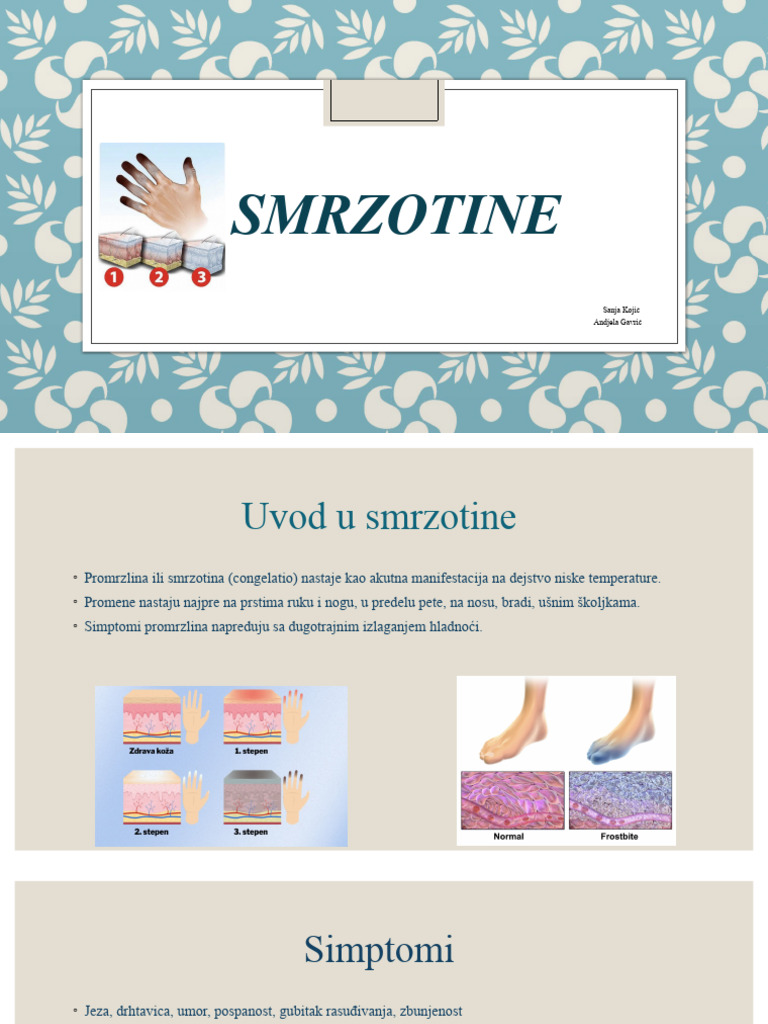Smrzotine | PDF