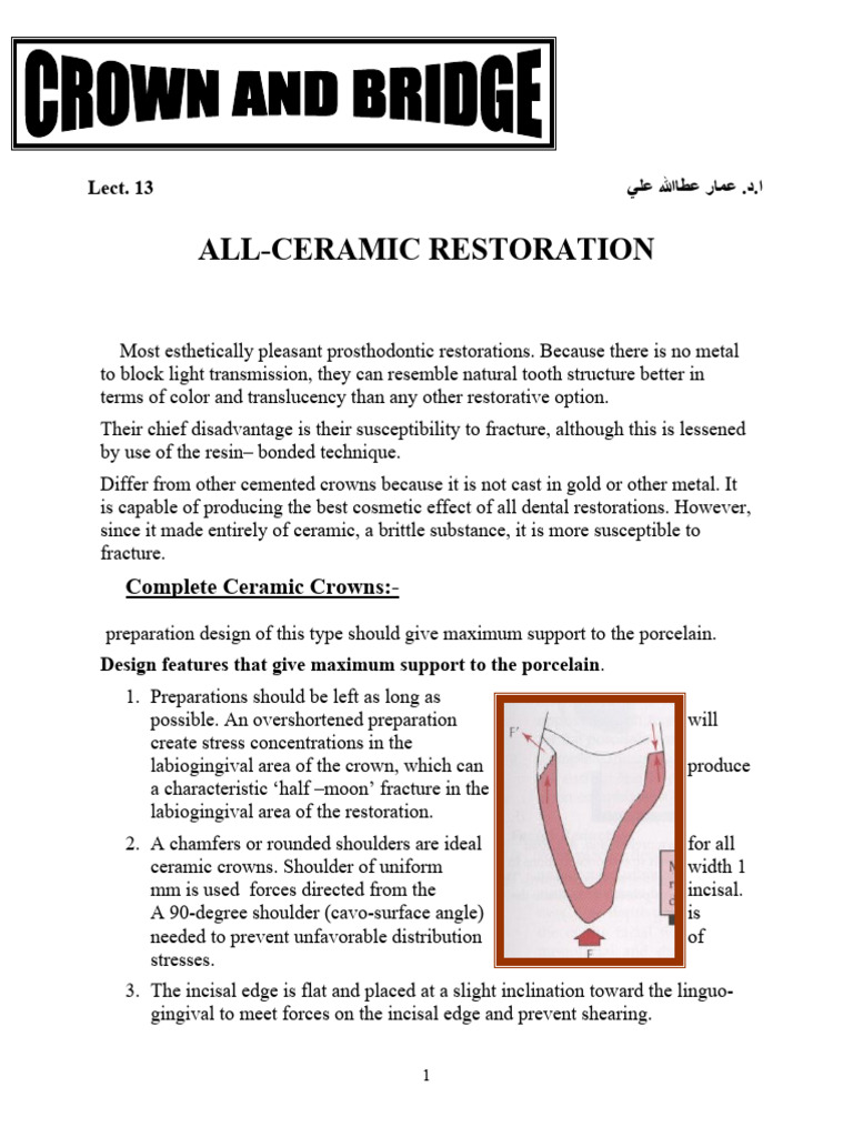 13 All-Ceramic Restoration | PDF | Ceramics | Materials