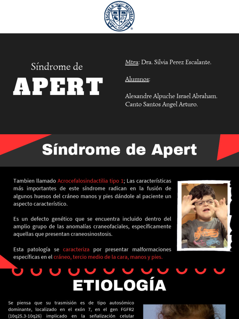 Síndrome de apert | PDF | Especialidades Medicas | Enfermedades y ...