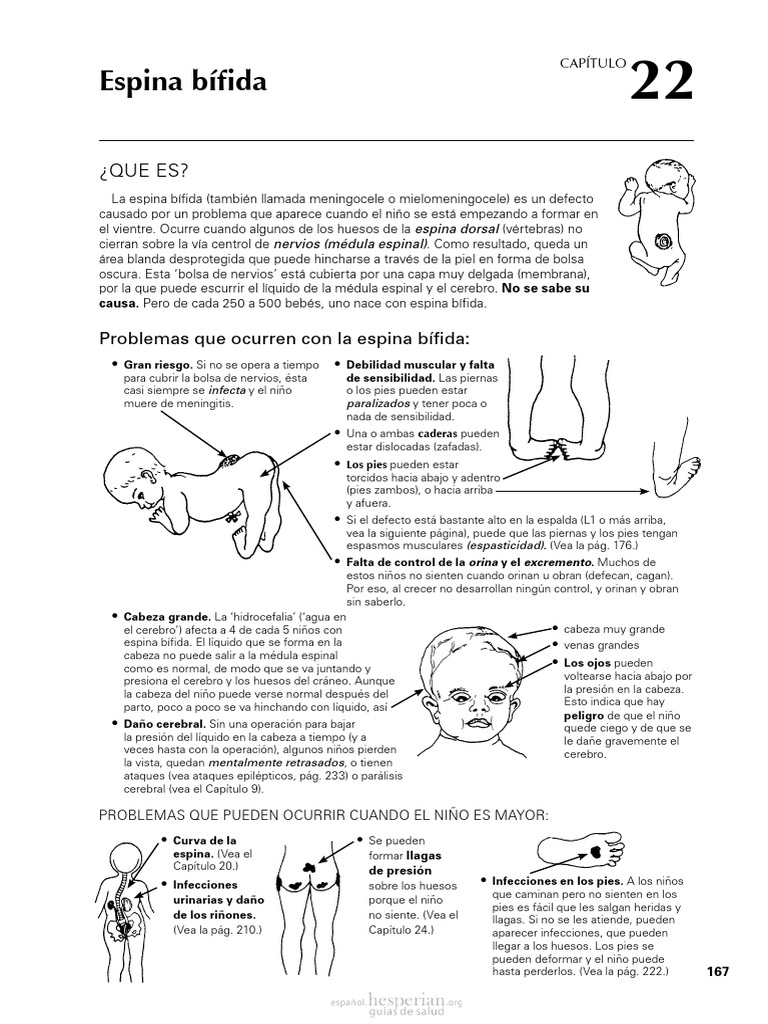Capitulo22 Espina Bifida | PDF | Vértebra | Anatomía