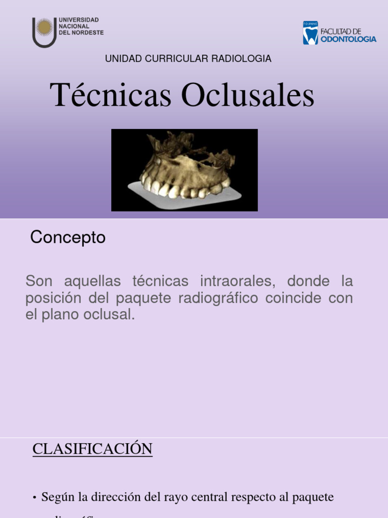 Tecnicas Oclusales y Bite Wing 2024 | PDF | Boca | Diente