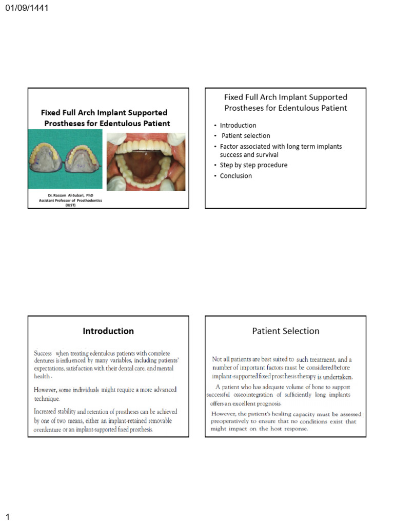 3 - Fixed Full Arch Implant For Edentulous Patient | PDF
