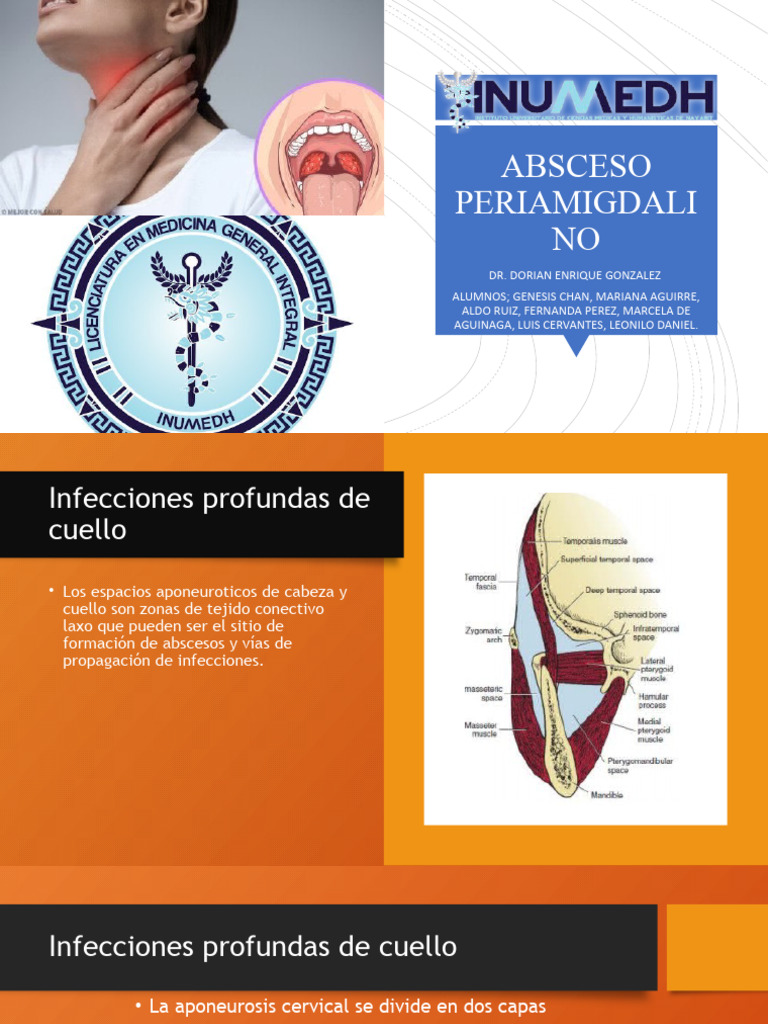 Manejo del absceso periamigdalino | PDF | Estreptococo | Neumonía