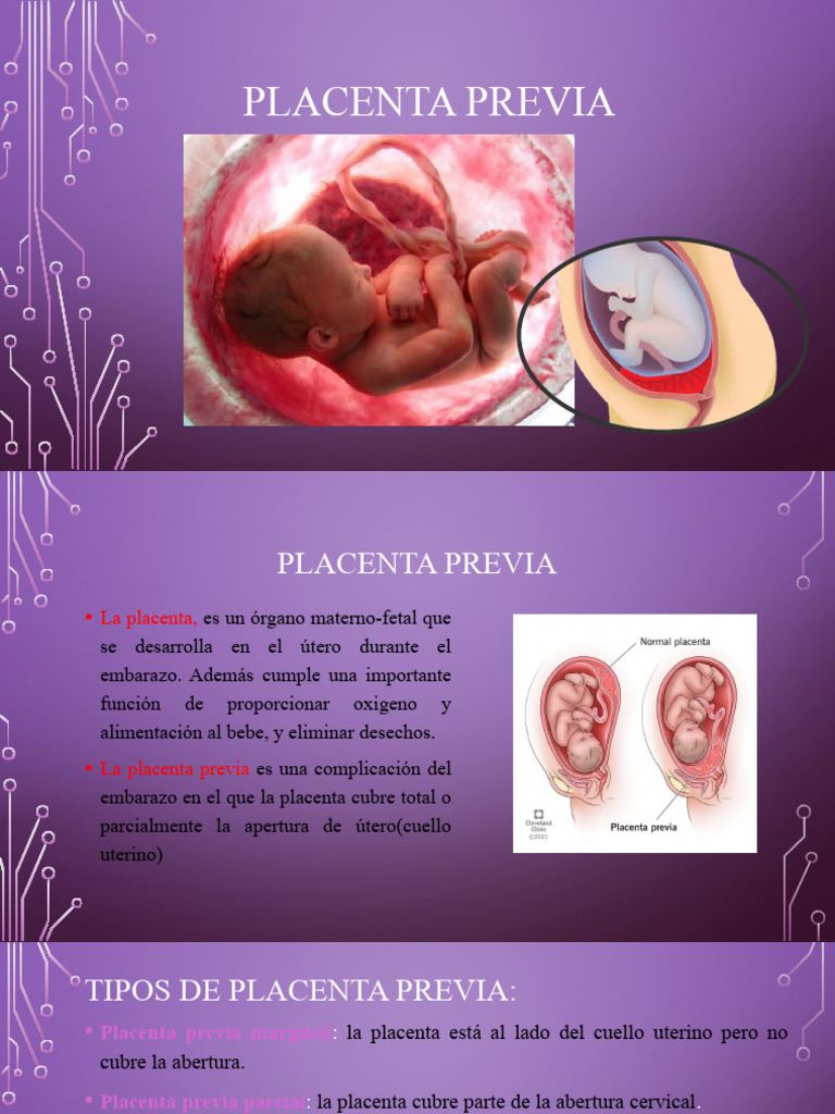 Placenta Previa: Tipos y Riesgos | PDF