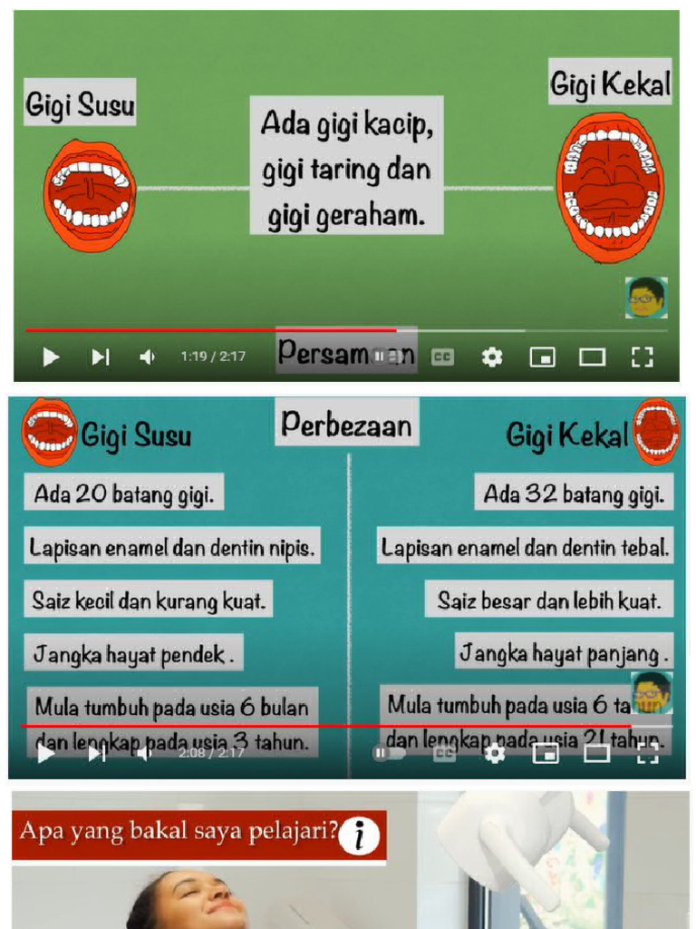 Persamaan Perbezaan Gigi Susu Gigi Kekal | PDF
