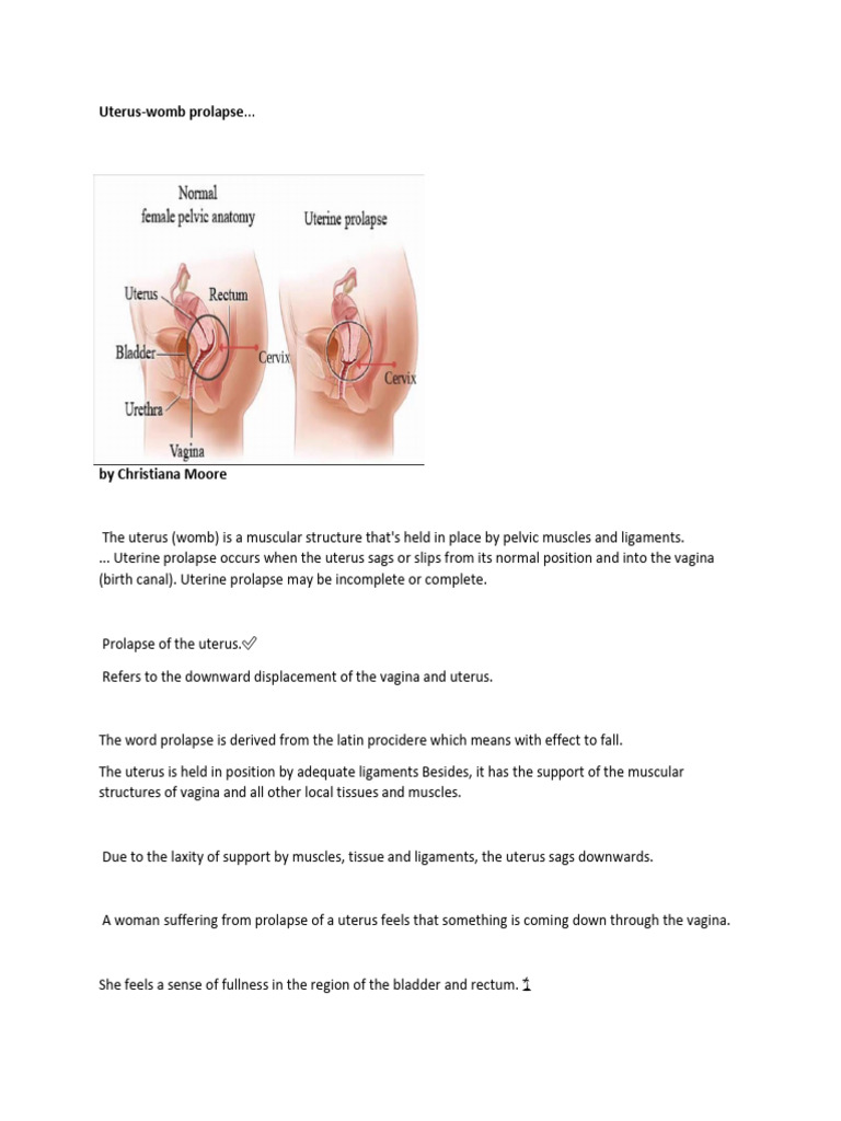 #1uterus-Womb Relapse#1 | PDF | Vagina | Uterus
