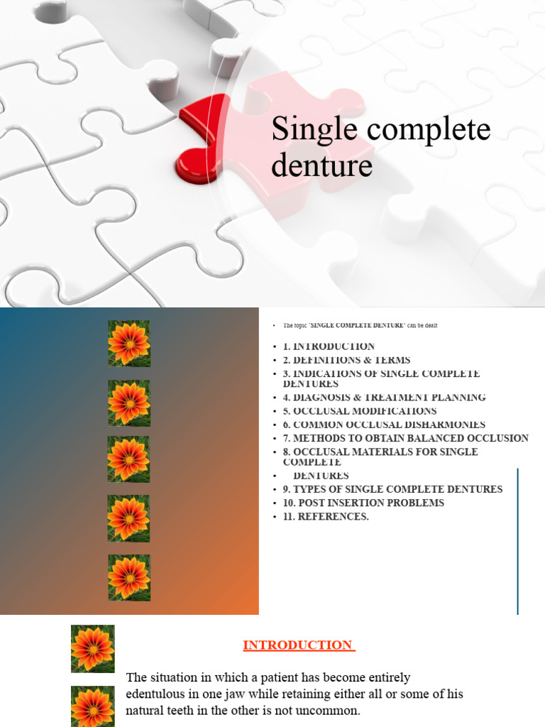 Single Complete Denture | PDF | Dentures | Mouth