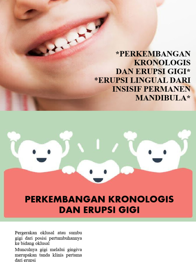 Perkembangan Kronologis Dan Erupsi Gigi, Erupsi Lingual Dari Insisif ...